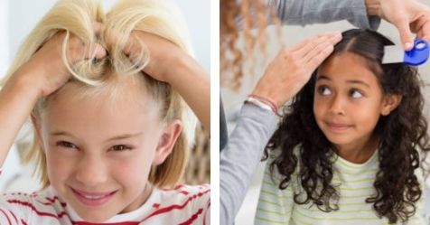 6 of the best nit treatments plus how to catch them!| Bounty Parents