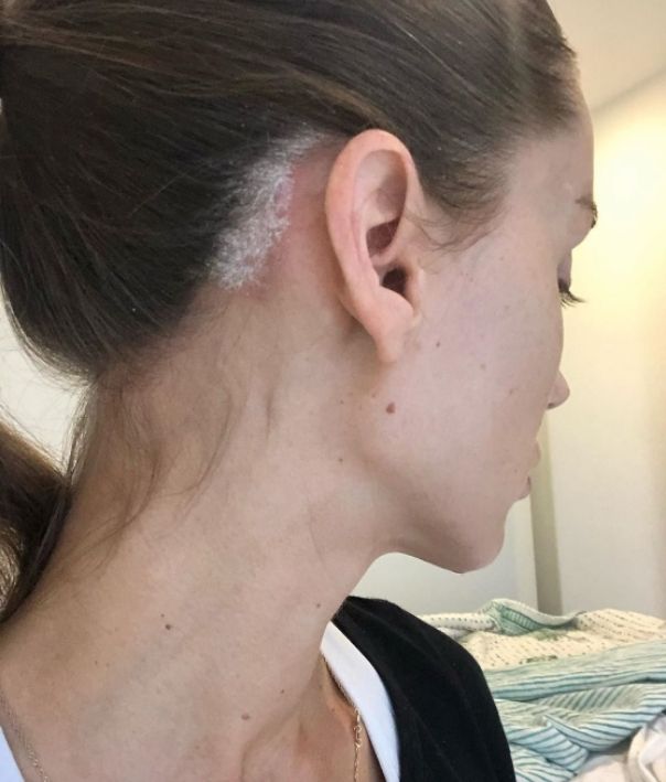Influencer Krystal Hipwell gets real about her pregnancy health ...
