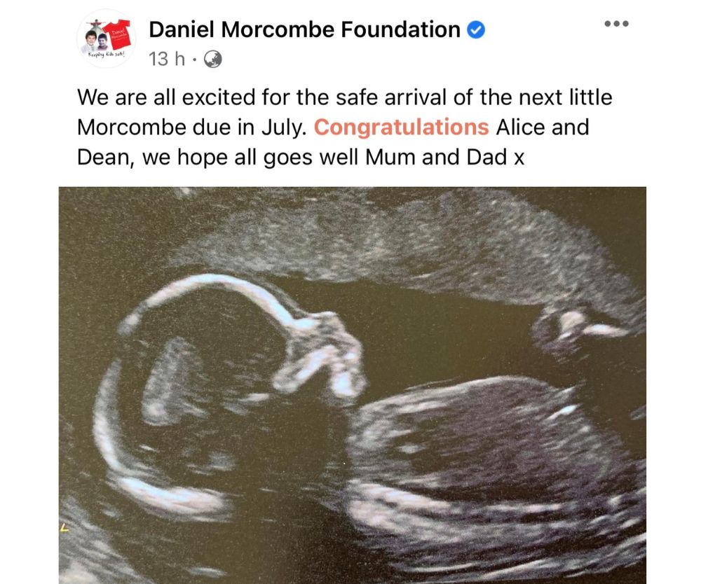 Baby joy for the Morcombe family | Bounty Parents