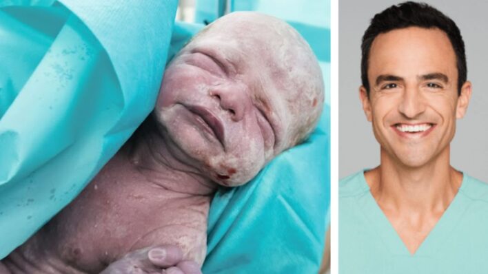 Dr Golly newborn appearance It’s normal for your baby to look a bit ...