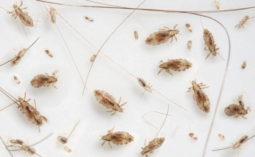 How to treat the new breed of 'super' head lice | Bounty Parents